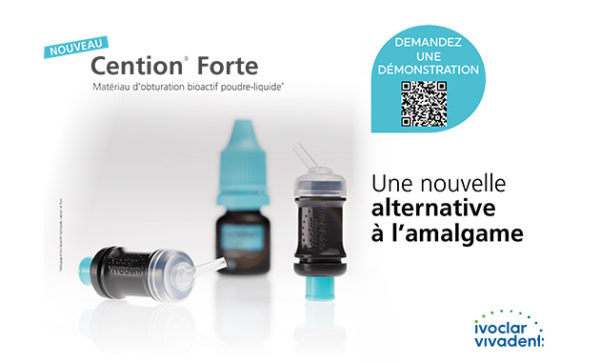 Cention Forte : une alternative à l'amalgame - Dentaire365