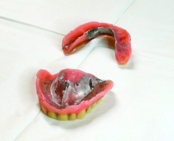 Dentaire365 - La prothèse complète avec le numérique