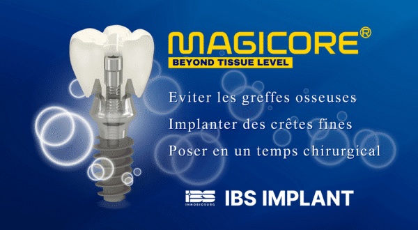 Dentaire365 - MAGICORE, IMPLANT MINIMALEMENT INVASIF – PRINCIPES DE ...