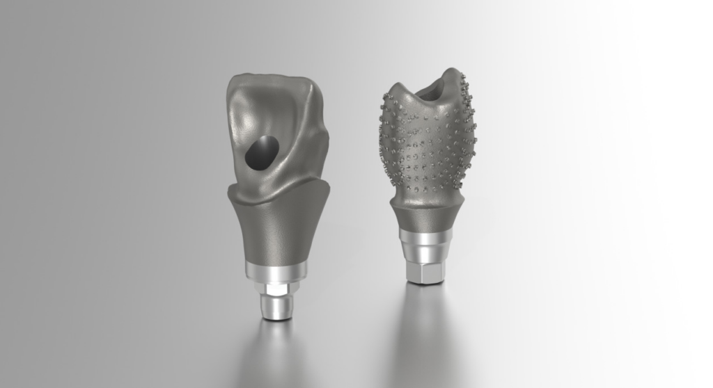 Dentaire365 - Flux numérique implantaire